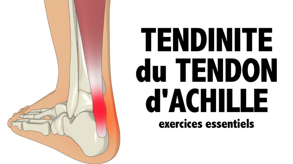 Tendinite du tendon d'Achille: des exercices essentiels (niv. 2 ...